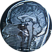Pain Assessment Tool - Test - Rejuvinix